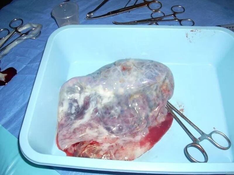 Hospital cleaner arrested for allegedly trying to sell human tissue