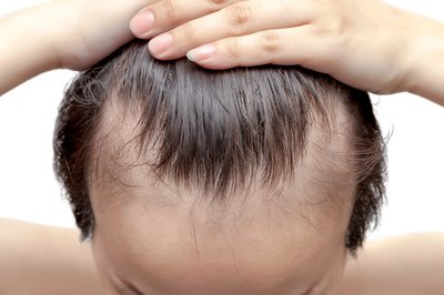 Tips for restoring your hairline