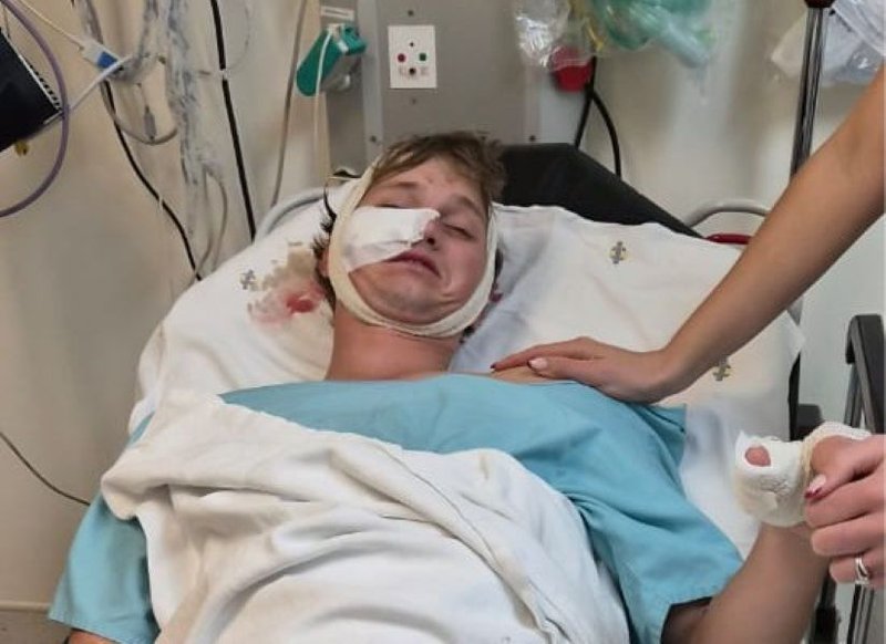 LISTEN | Cape Vidal horror: Hyenas maul camper’s son in midnight attack
