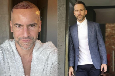 Hair loss in men - Janez Vermeiren shares his story