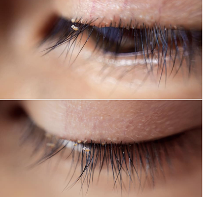 Love your lashes? Beware of lash lice!