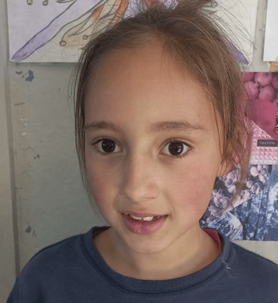 Young Secunda girl slowly losing her eyesight