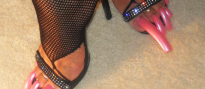 Long toenails: A growing trend