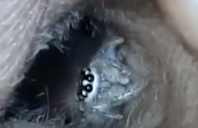 Terrifying moment when spider crawls out of woman's ear!