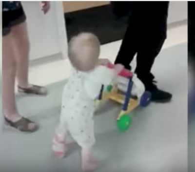 Toddler takes first steps moments before his leg gets amputated