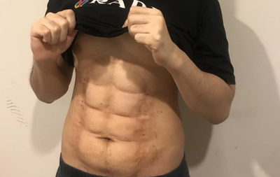 Thai hospital offers 'pain-free, instant' six-pack surgery