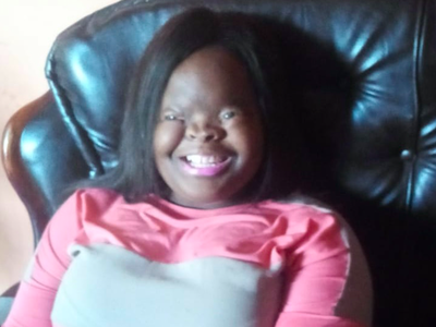 Cape Town woman with no eyes talks about rare condition