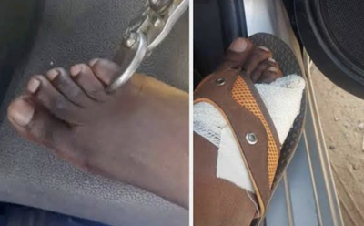 Are these people really cutting off their big toes for money?