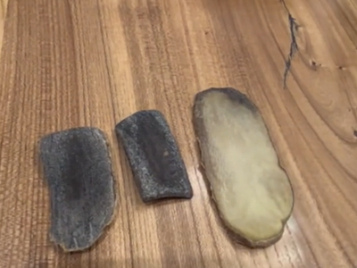 Mom shows what happens when she places a potato slice on her sick child ...