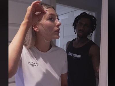 Woman pranks BF into thinking her skin is shedding