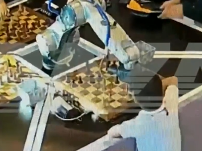 WATCH: Seven-year-old boy's finger is left broken by a robot during ...