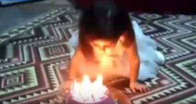 Girl’s hair catches fire as she blows out birthday candles