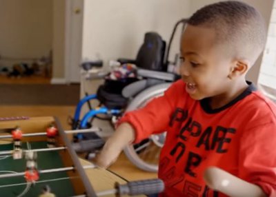World's first child hand transplant a 'success'